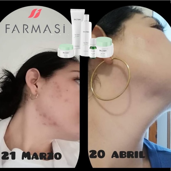 Farmasi | Skincare | Farmasi Tea Tree Set | Poshmark
